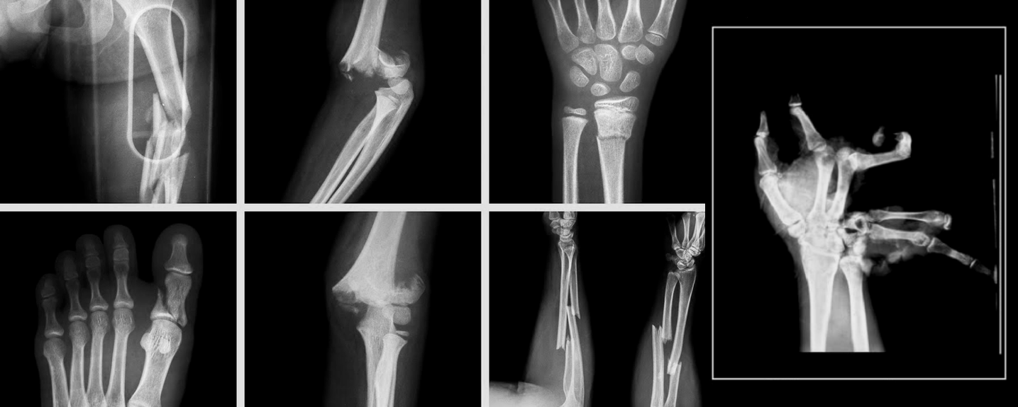 Shield Radiology – Radiology Reports and Consulting